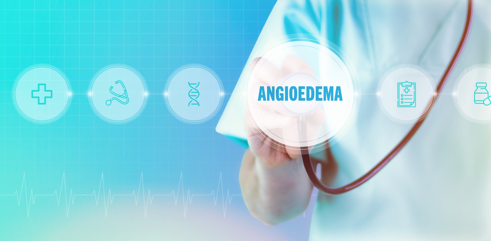 Vorsicht vor Fehldiagnosen beim hereditären Angioödem!